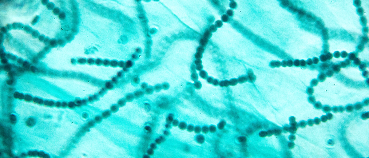 Algal Biotechnology | EIT Food Learning Services